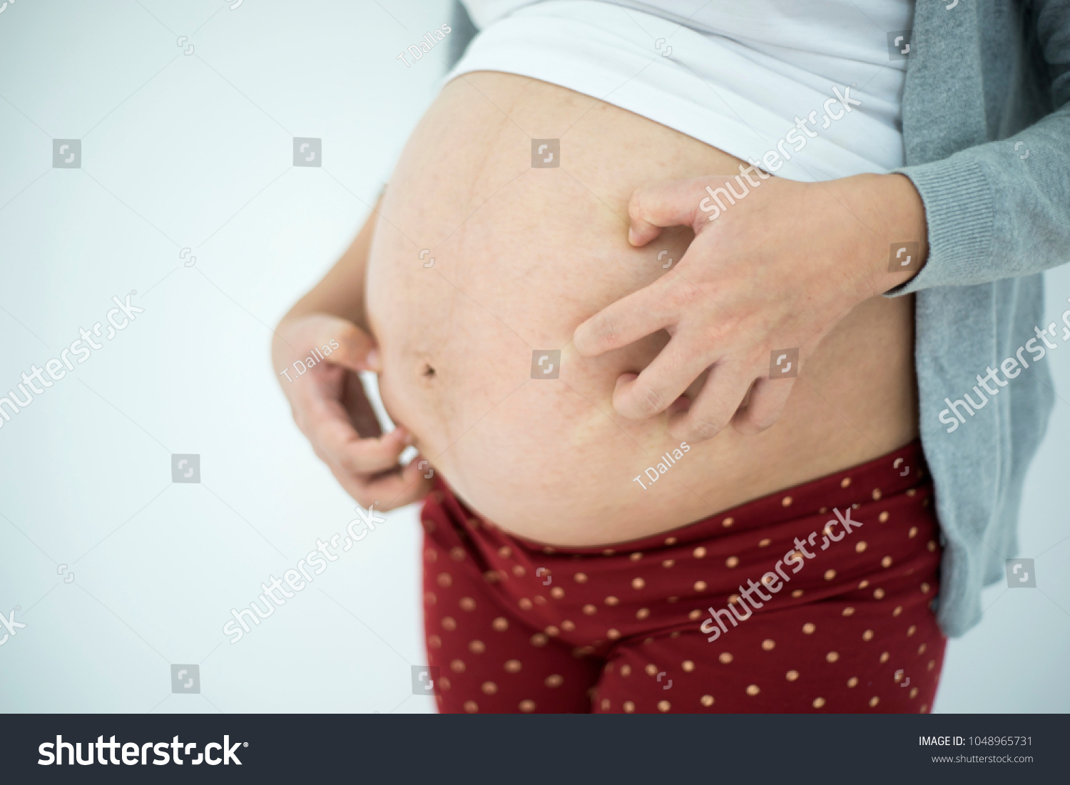 Pregnant woman scratching belly because itchy skin_站酷海洛_正版图片_视频_字体_音乐素材 ...